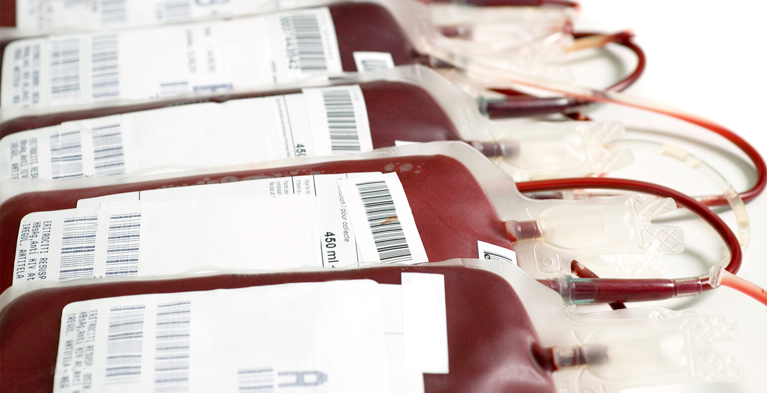 How can we improve blood transfusion practices? - Westat