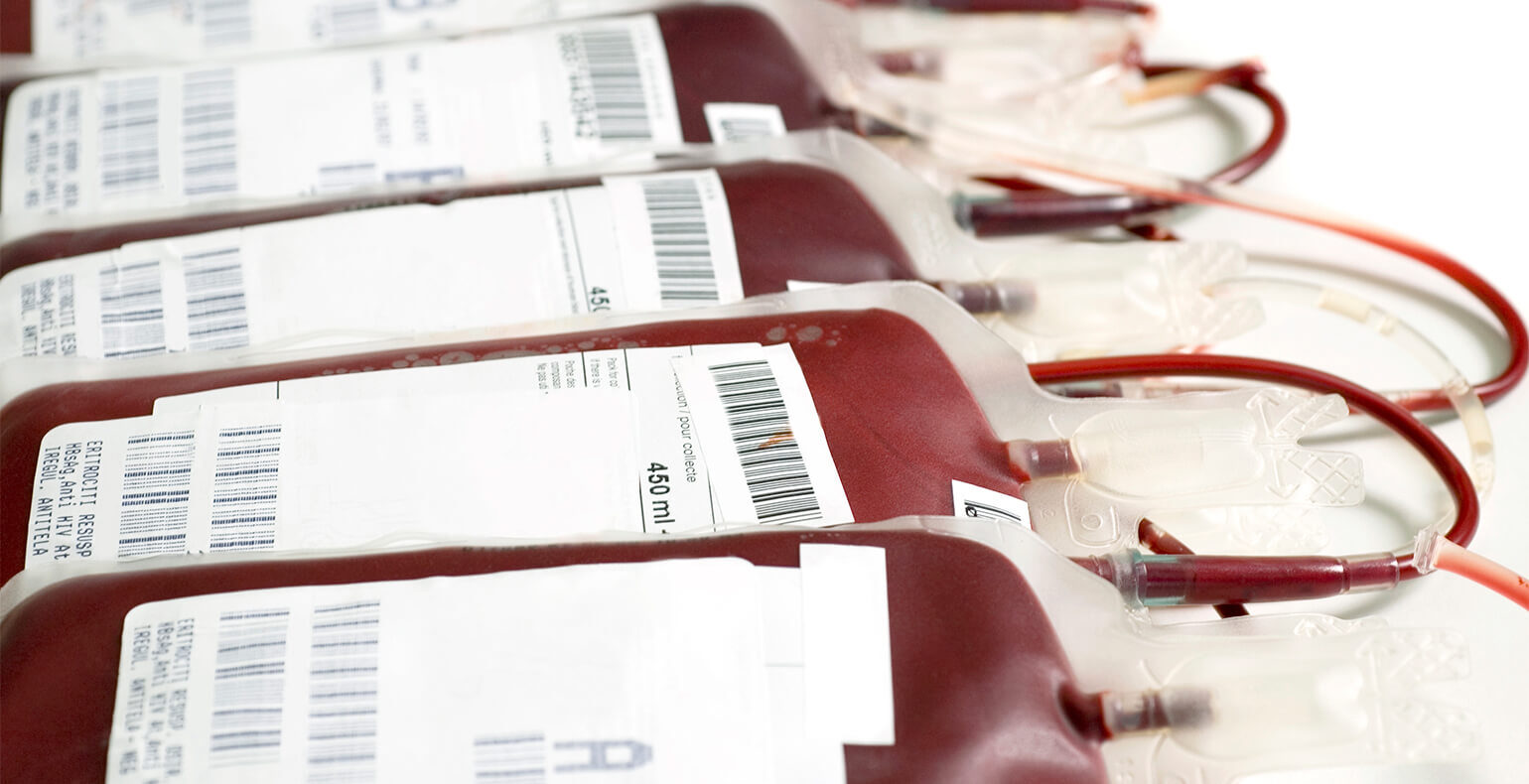 How can we improve blood transfusion practices? - Westat